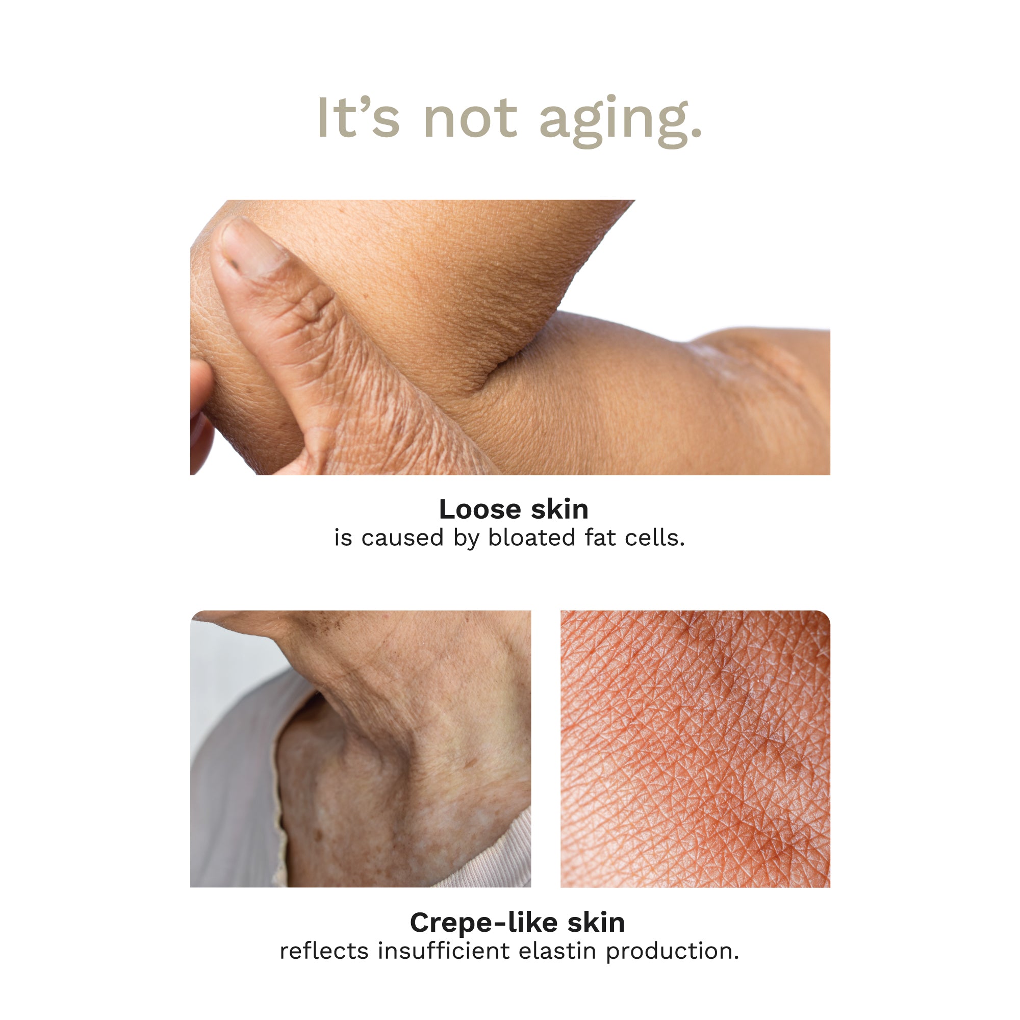 Strong Body Gel by Adipeau: Firm and Tone Your Skin